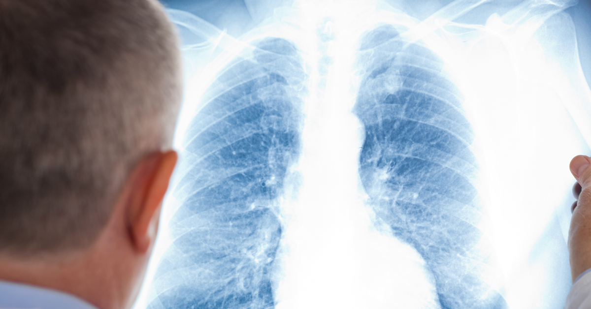 Pulmonology - Forrest City Medical Center
